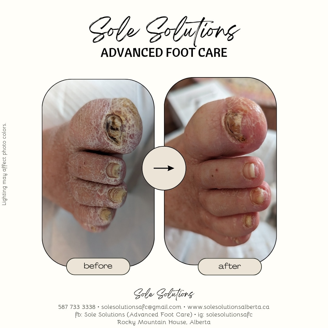 Our Work – Sole Solutions